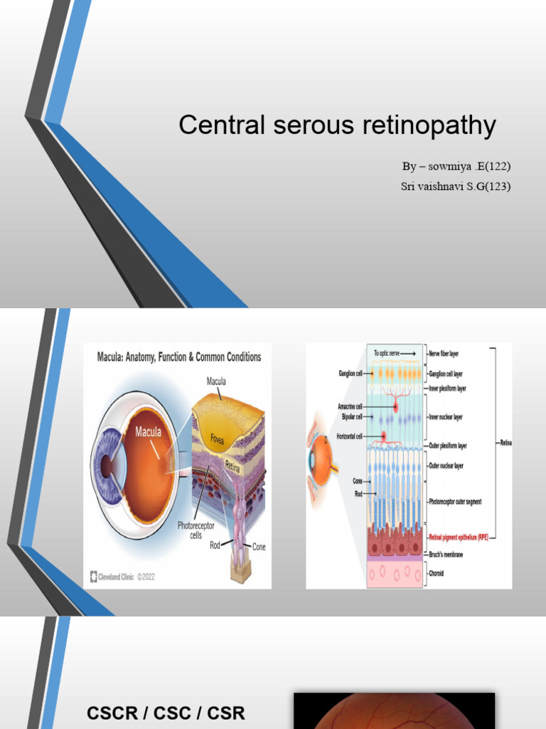 Central Serous Retinopathy Overview | PDF | Medicine | Clinical Medicine