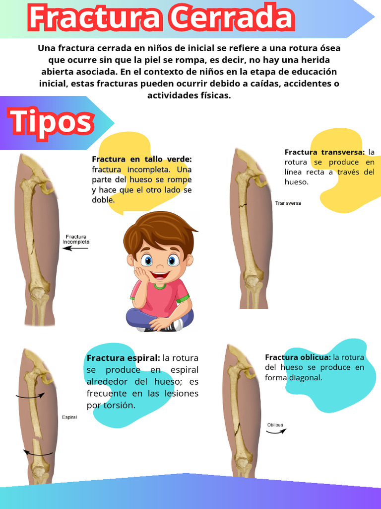 Fractura en Tallo Verde Fractura Incompleta. Una Parte Del Hueso Se ...