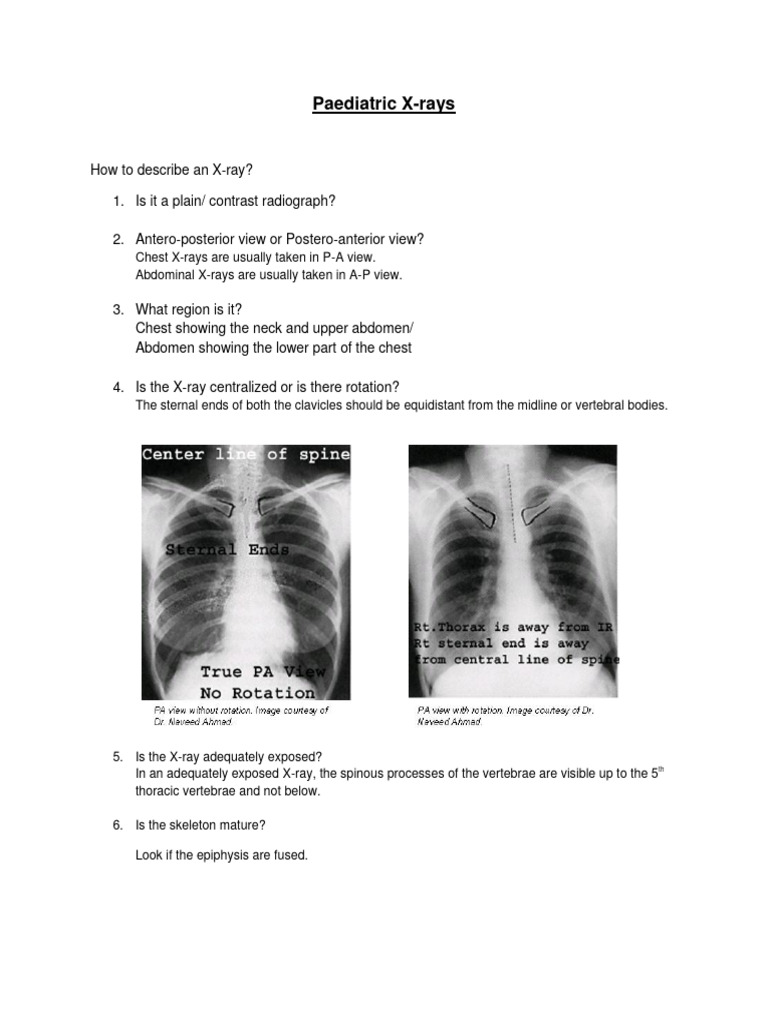 Notes of Paediatrics X-Rays | PDF | Thorax | Lung