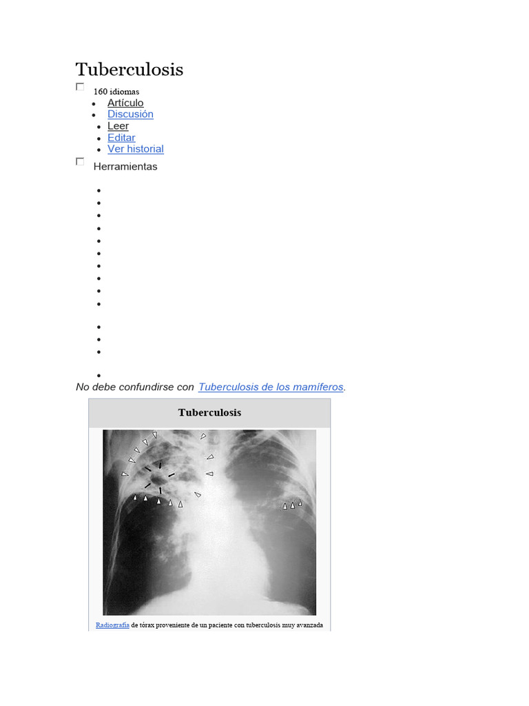 Tuberculosis | PDF | Tuberculosis | Inmunología