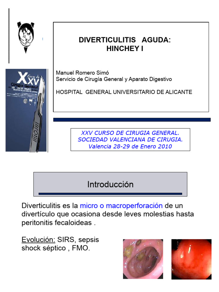 Diverticulitis Aguda Tratamiento | Descargar gratis PDF | Septicemia | Especialidades Medicas