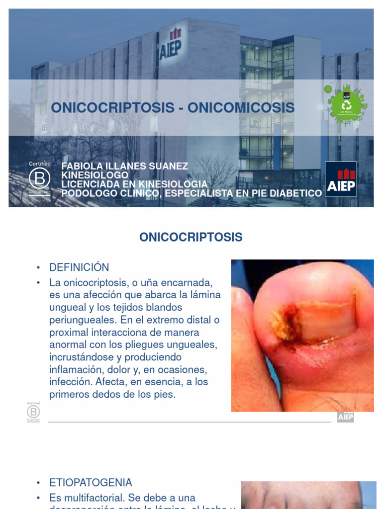 Clase N°7 Onicocriptosis-Onicomicosis | PDF | Clavo (anatomía) | Medicina