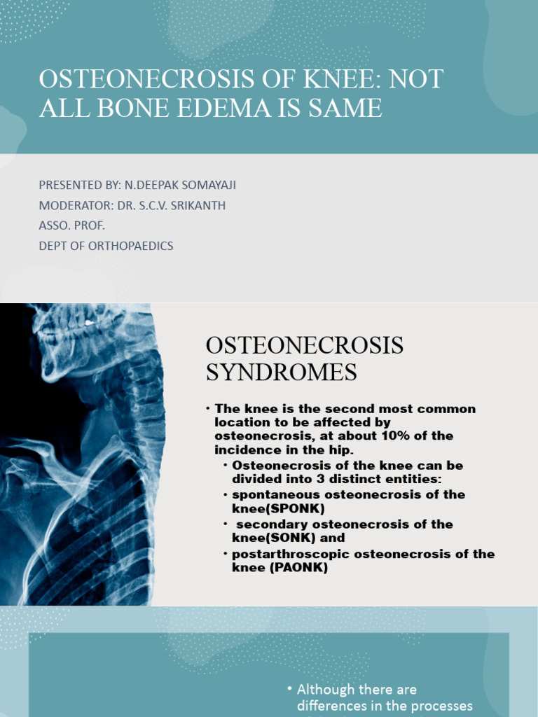 SPONK and Osteonecrosis of the Knee | PDF | Musculoskeletal Disorders ...