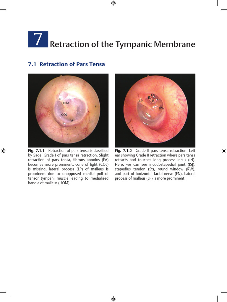 Ghosh - Sample Chapter | PDF | Ear | Human Head And Neck Ghosh - Sample Chapter | PDF | Ear | Human Head And Neck