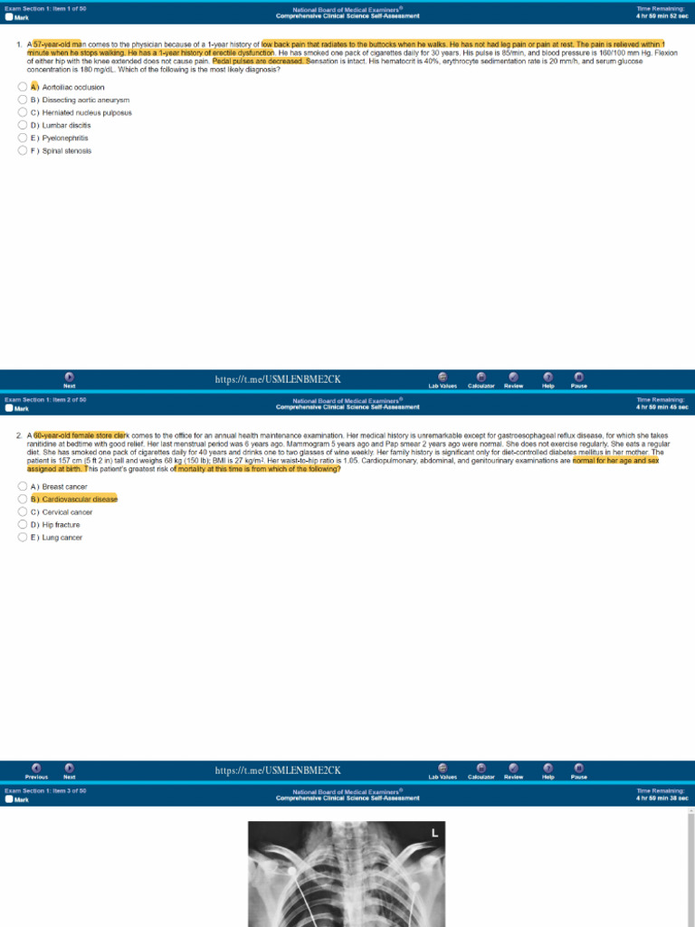 NBME 12 - Questions | PDF | Physical Examination | Breathing