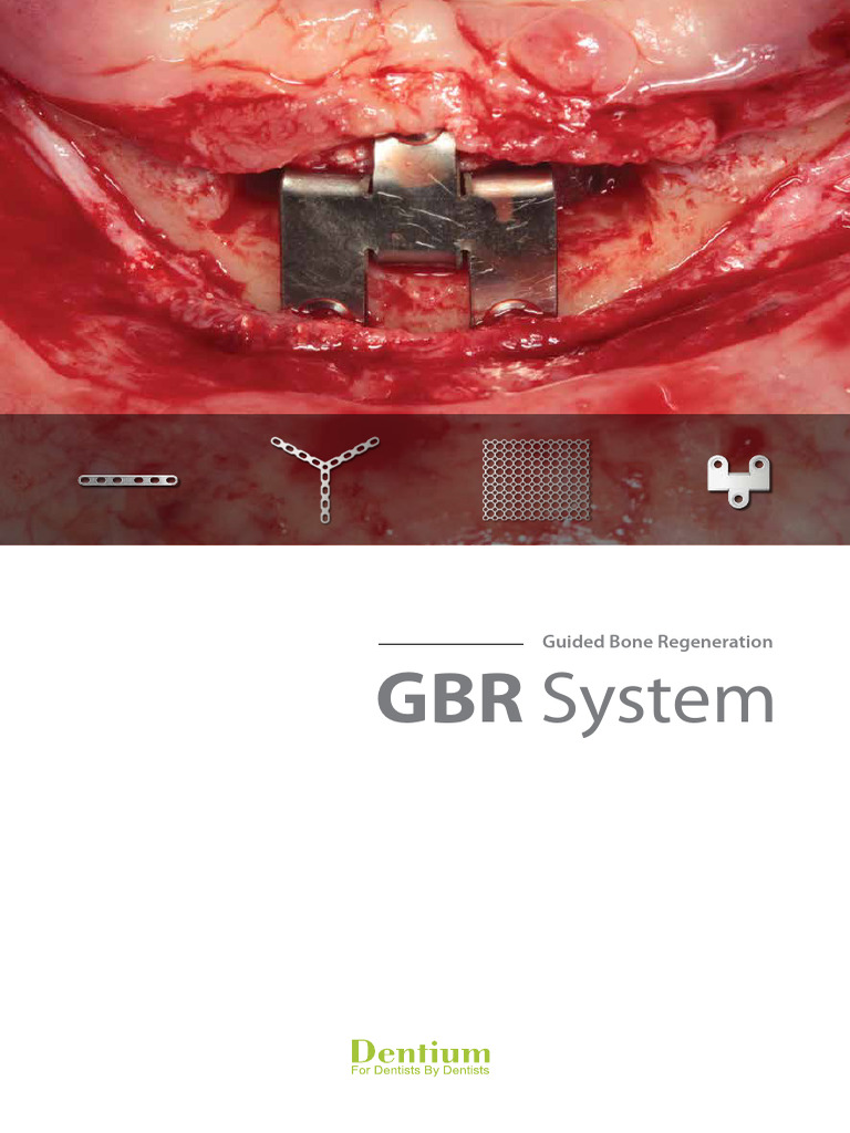 GBR System | PDF | Screw | Manufactured Goods