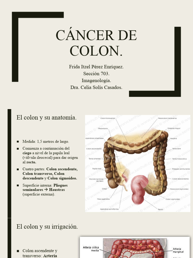 Cáncer de Colon Imagenología | PDF | Cáncer colonrectal | Intestino grueso