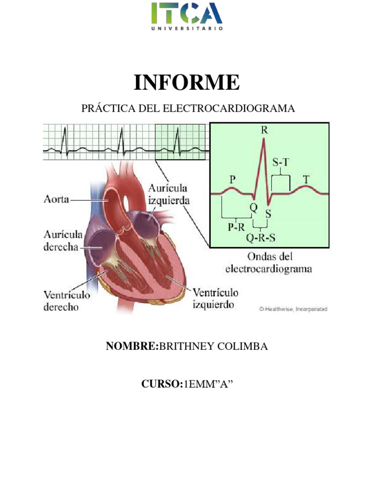 Práctica de Electrocardiograma en Niños | PDF | Electrocardiografia ...