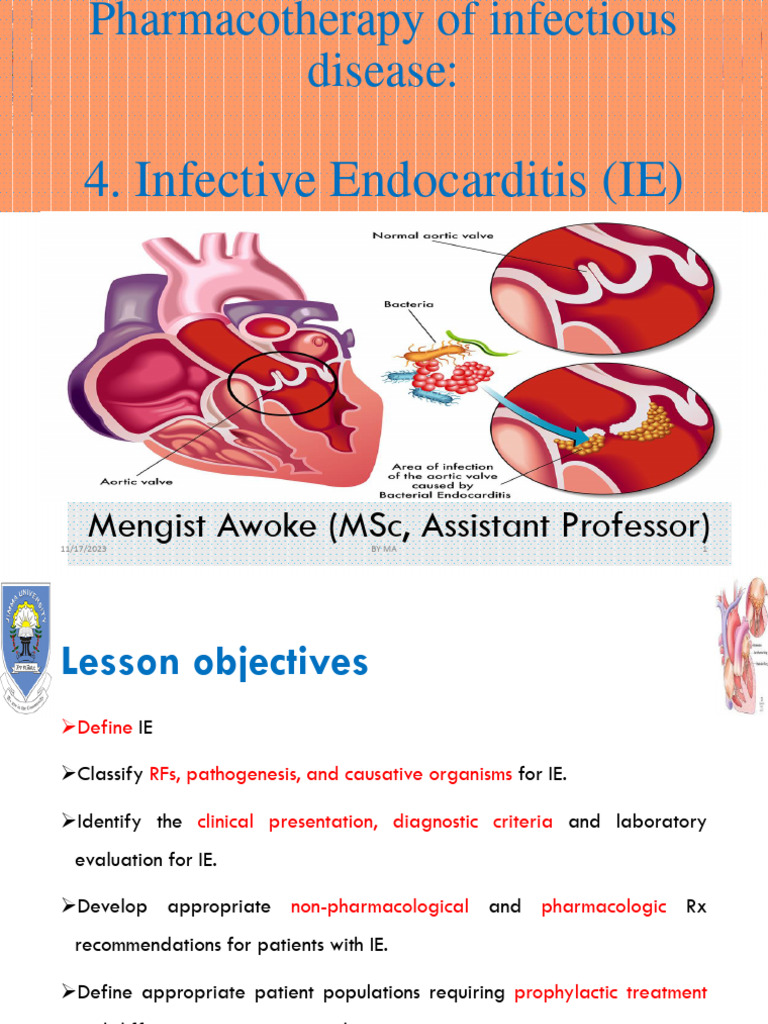 Infective Endocarditis (Ie) : Mengist Awoke (MSC, Assistant Professor) | PDF | Clinical Medicine ...
