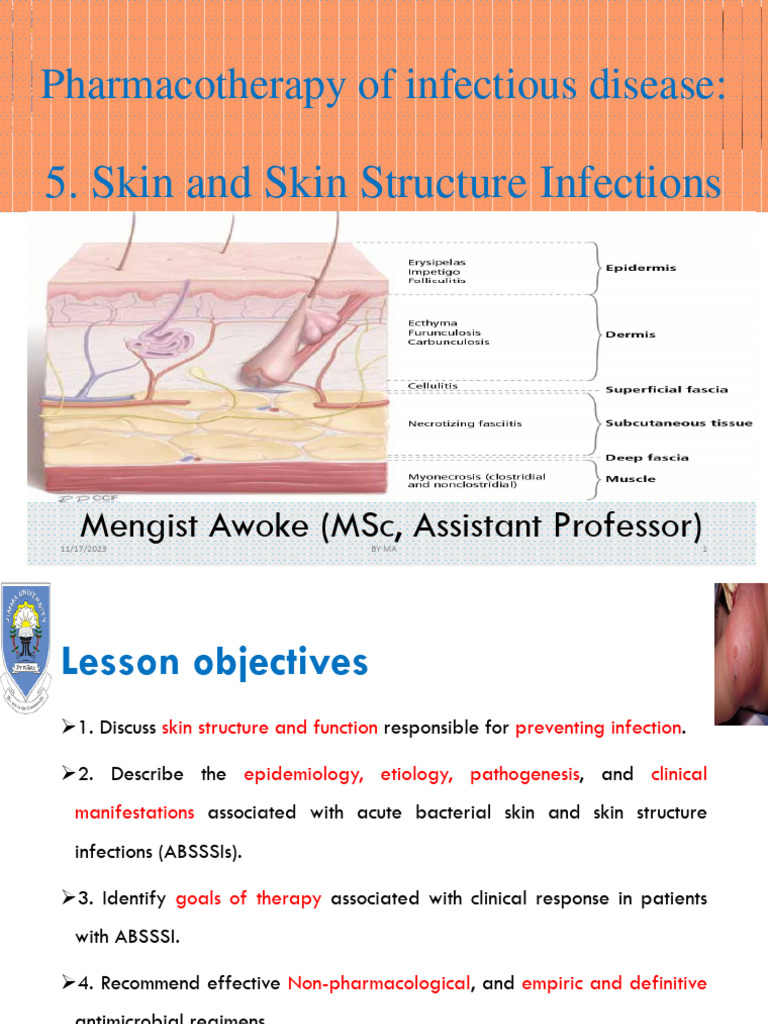 SSTI | PDF | Infection | Epidemiology
