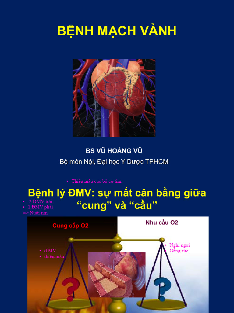 (Vũ) BENH MACH VANH ? | PDF