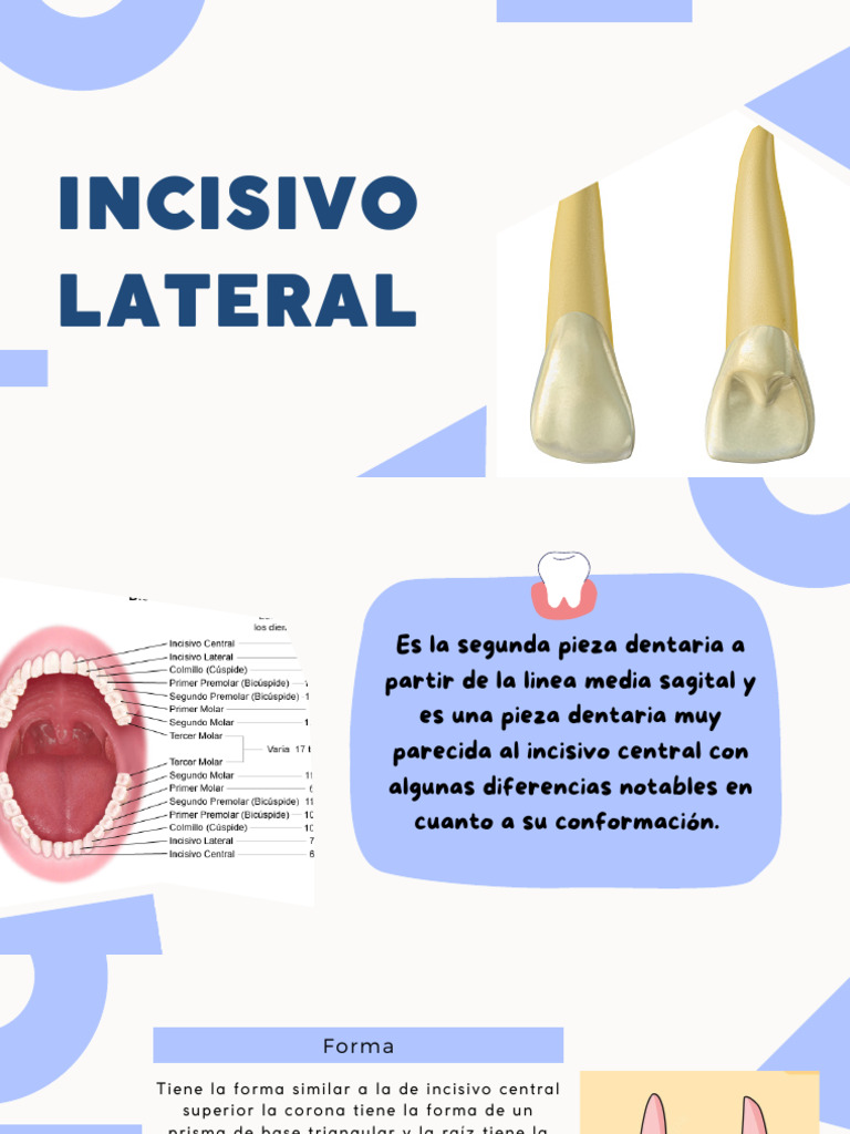 Incisivo Lateral | PDF