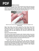 Elonide Nasal Spray Mometasone Furoate HOE PHARMACEUTICALS SDN BHD ...
