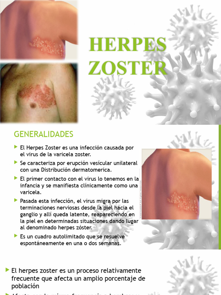 Herpes Zoster | PDF | Enfermedades virales | Especialidades Medicas