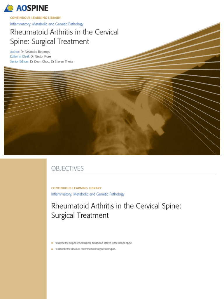 Rheumatoid Arthritis in Cervical Spine New | PDF | Vertebral Column ...