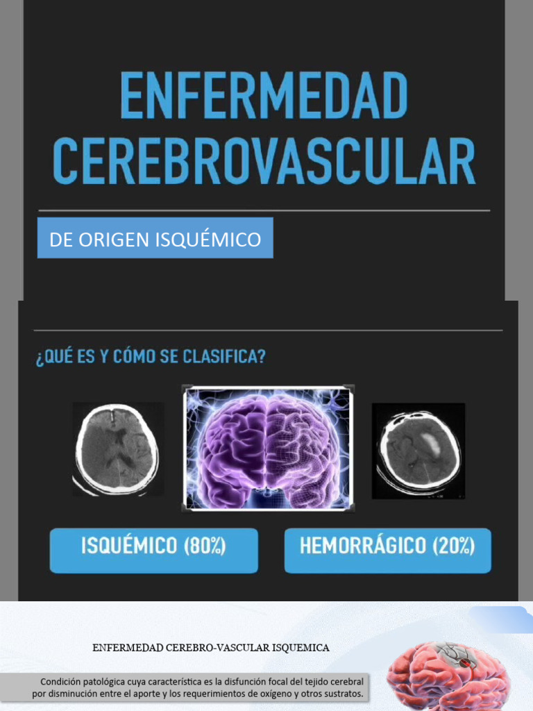 Ecv Isquemico Presentación | PDF | Carrera | Isquemia