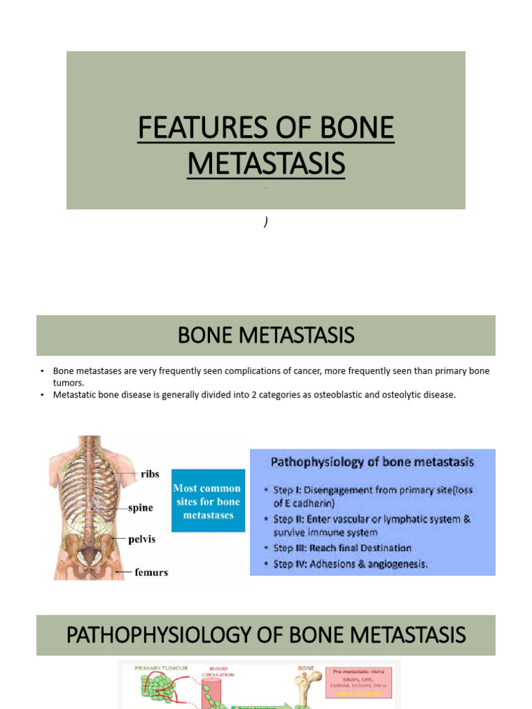 Xray Mets Bone | PDF