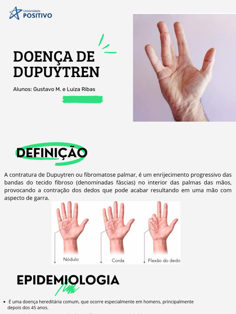 Doença de Dupuytren | PDF | Dor | Cirurgia ortopédica