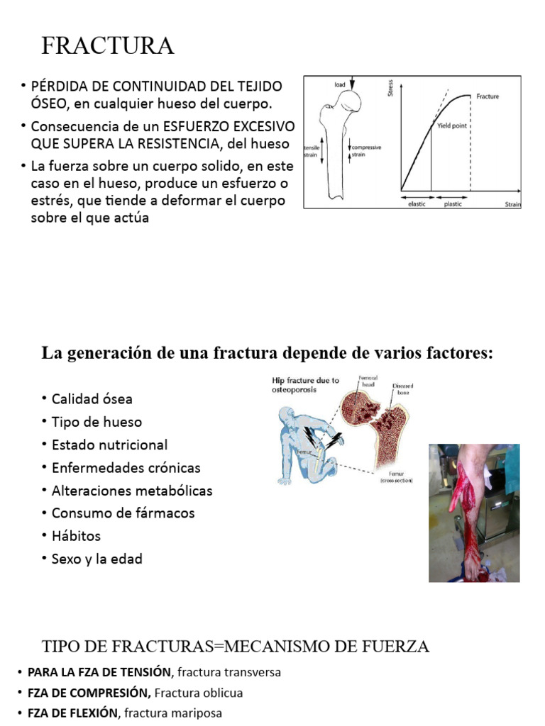 Frac Tura | PDF | Músculo esquelético | Isquemia