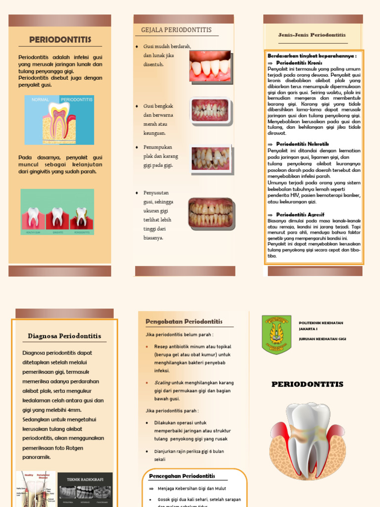 Periodontitis Leaflet | PDF
