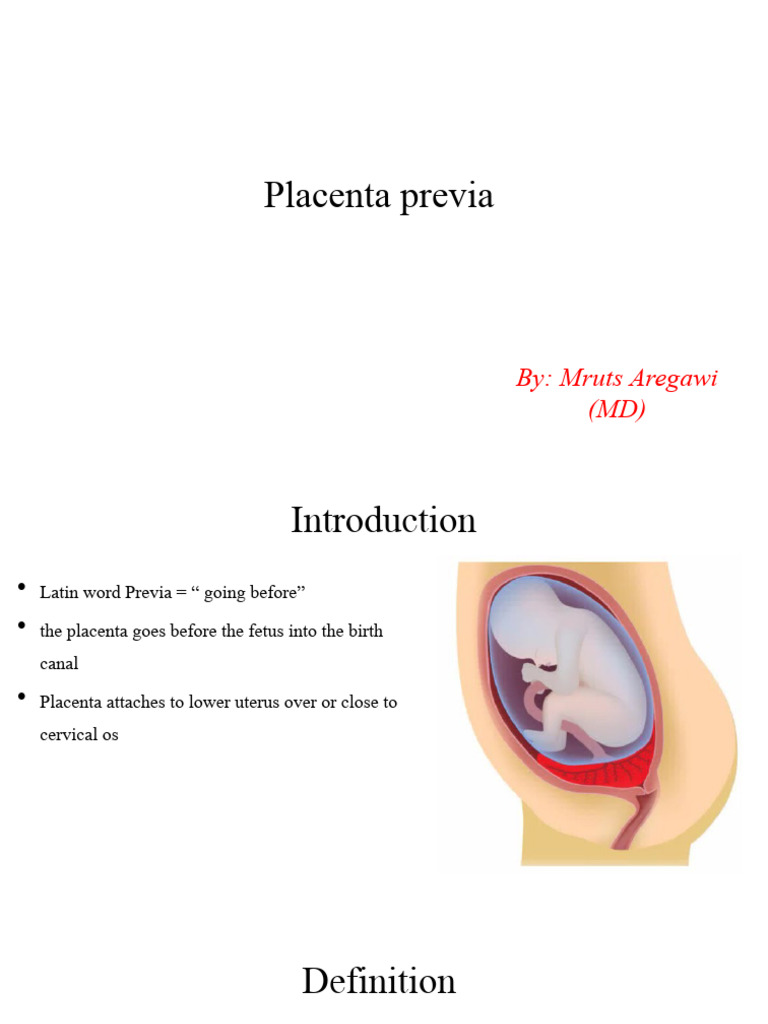 Placenta Previa | PDF | Placenta | Uterus