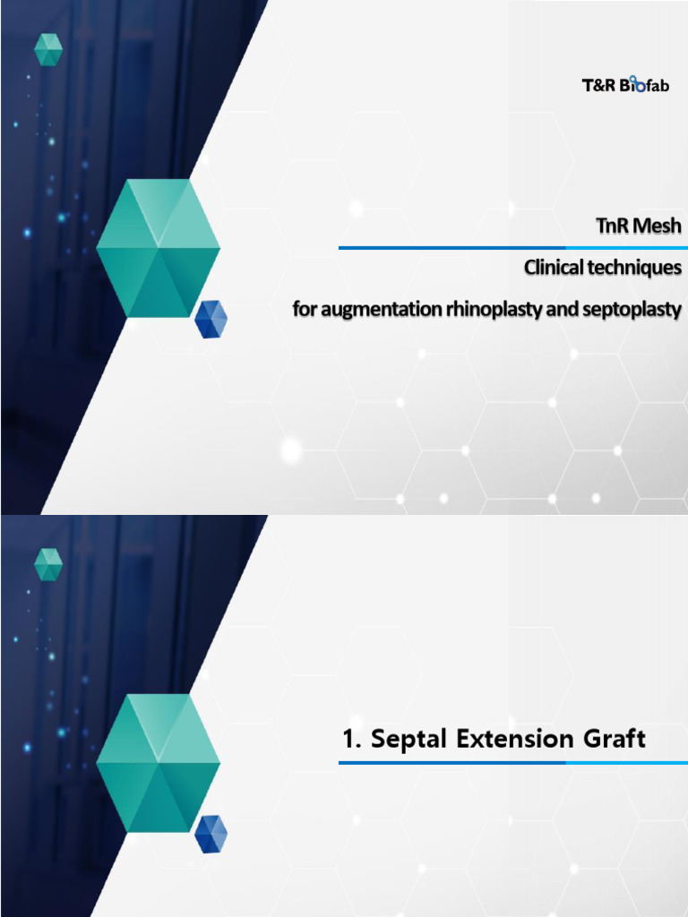 Clinical Techniques For Augmentation Rhinoplasty and Septoplasty ...