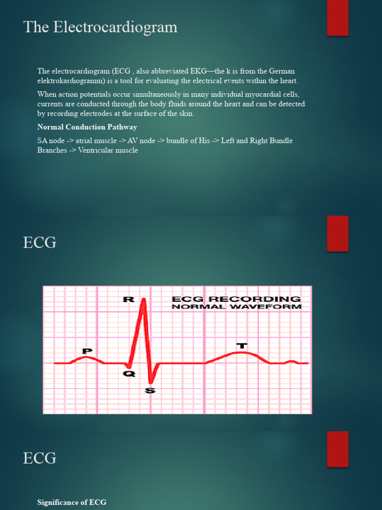 The Electrocardiogram: Normal Conduction Pathway | PDF ...