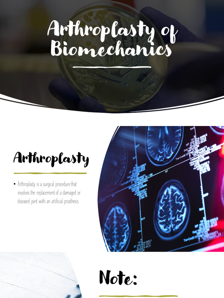 Biomechanics of Arthroplasty Tyba | PDF | Dental Implant | Prosthesis