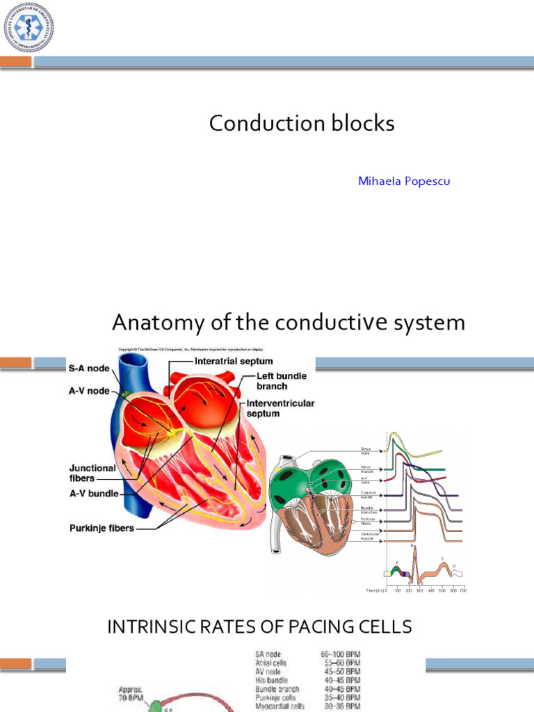 AV Conduction Blocks, BBB | PDF | Electrocardiography | Cardiac ...