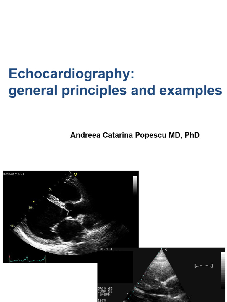Echocardiography General Principles and Examples | PDF