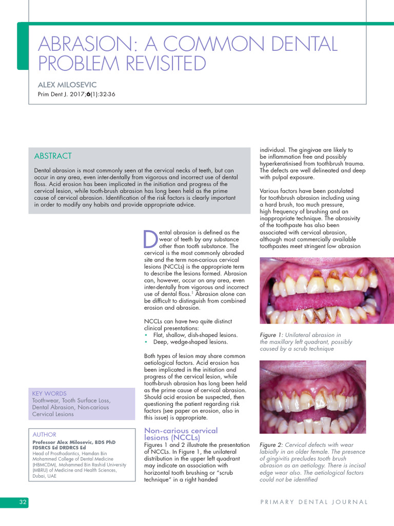 Paper Abrasion A Common Dental Problem | PDF | Medical Specialties ...
