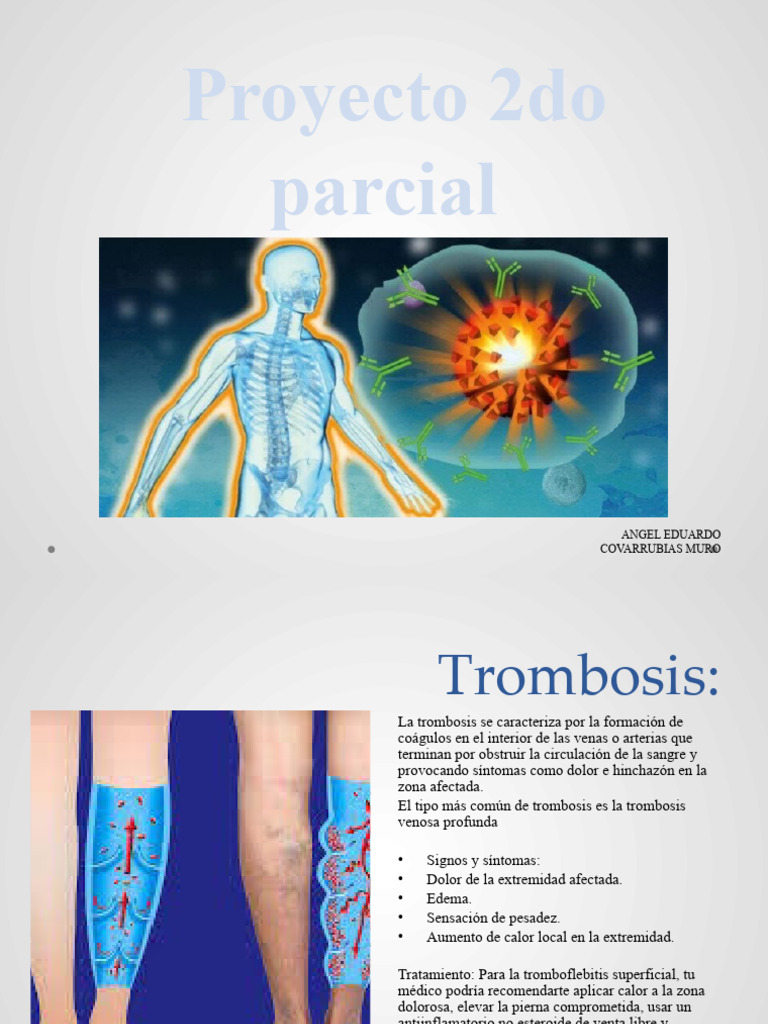 Proyecto 2do Parcial | PDF | Embolia | Trombo