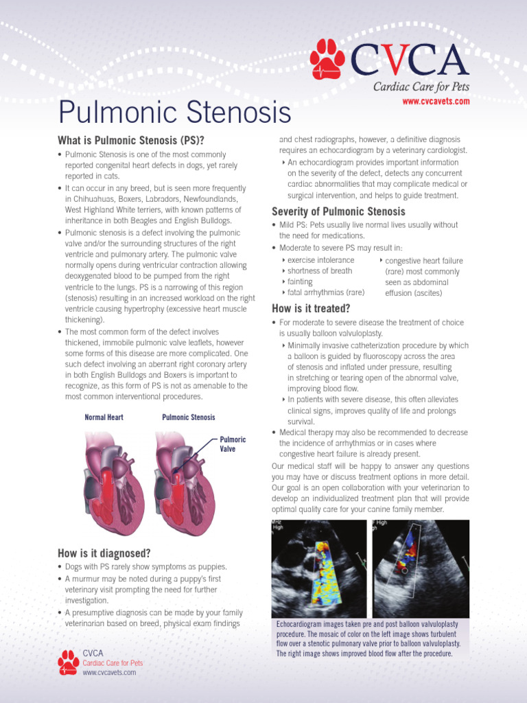 CVCA-Pulmonic-Stenosis 肺动脉狭窄介绍资料 | PDF | Heart | Cardiology