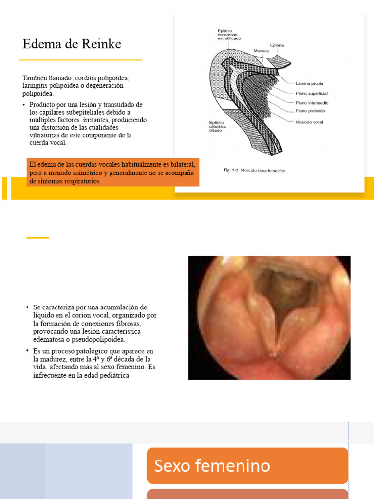 Edema de Reinke: Diagnóstico y Tratamiento | PDF | Tos | Laringe
