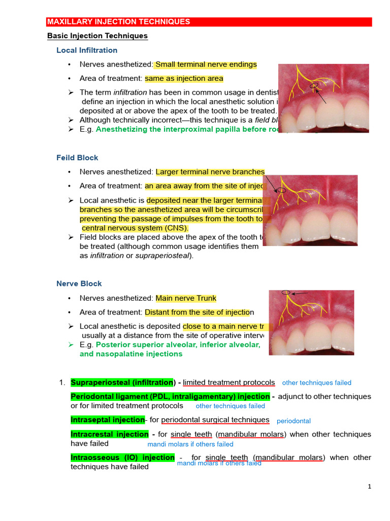 Maxillary Injection Techniques PPT I Sas 11-14 | PDF | Anesthesia ...