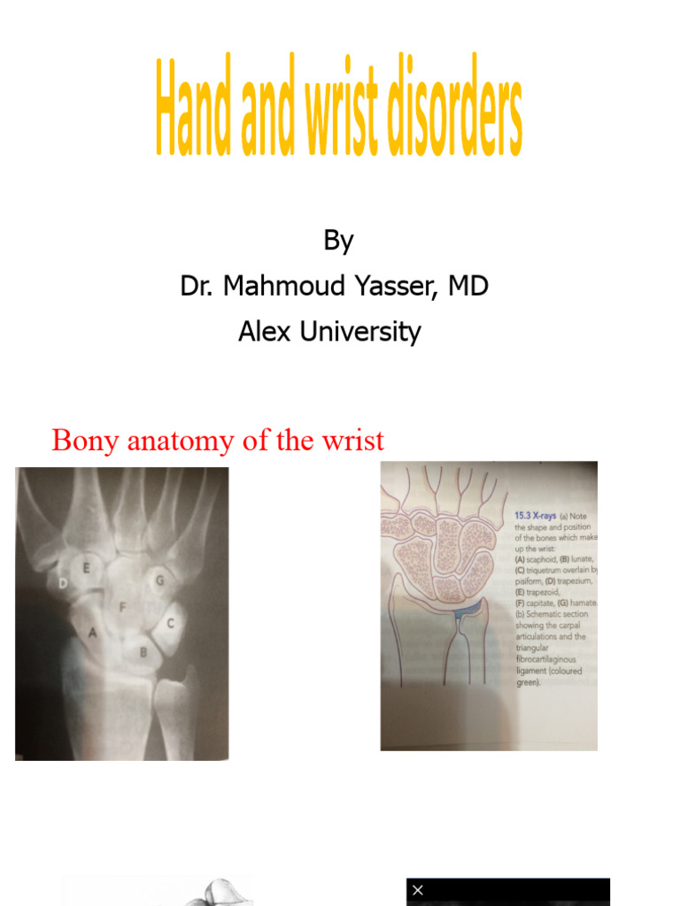 Hand and Wrist Disorders | PDF | Carpal Tunnel Syndrome ...