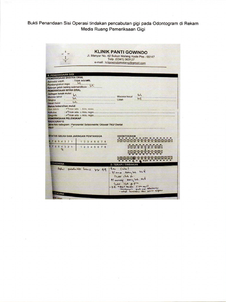 4-2. Bukti Penandaan Sisi Pada Tindakan Pencabutan Gigi PDF | PDF