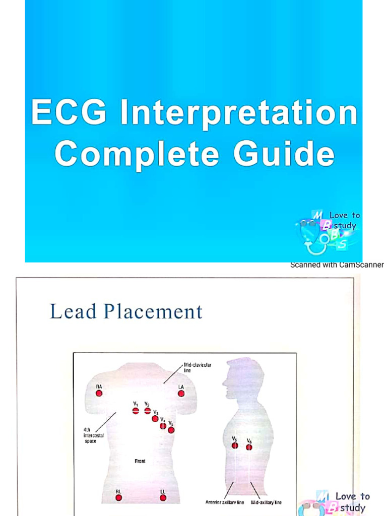 ECG Interpretation | PDF