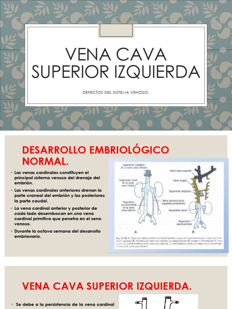 Persistencia de Vena Cava Superior Izquierda | PDF | Vena | Corazón