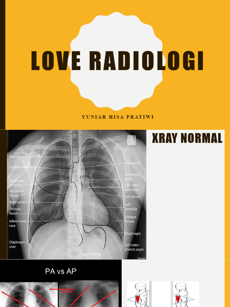 Love Radiologi by Hisa | PDF