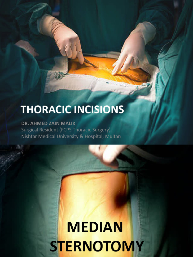 Thoracic Incisions Overview and Indications | PDF