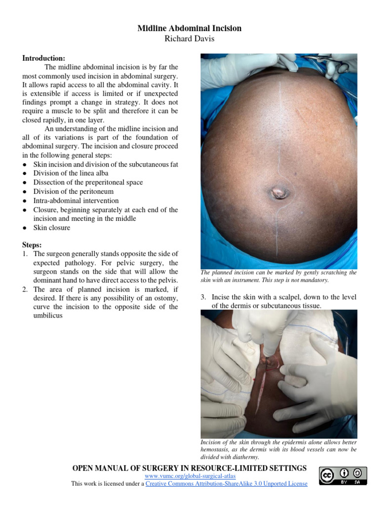 Surgical Guide for Resource-Limited Areas | PDF | Surgical Suture | Abdomen