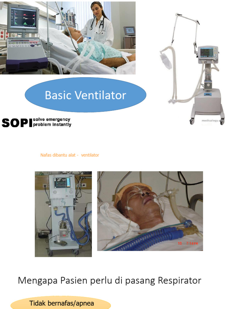 Ws2 - Ventilator NTT - Sopi | PDF
