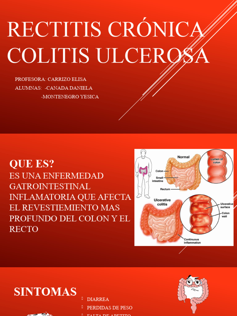 Rectitis Crónica - 111508 | PDF | Cuidado de la salud | Epidemiología