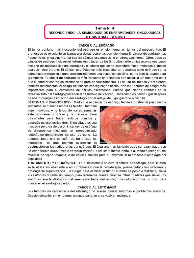 Tema 4 Onco 23 | PDF | Cáncer colonrectal | Cáncer