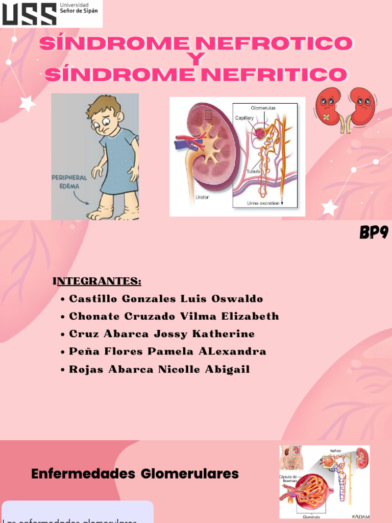 Sindrome Nefrotico y Nefritico | PDF | Edema | Nefrología