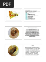 Gans Sensory Organization Performance (SOP) Test | PDF | Vertigo ...