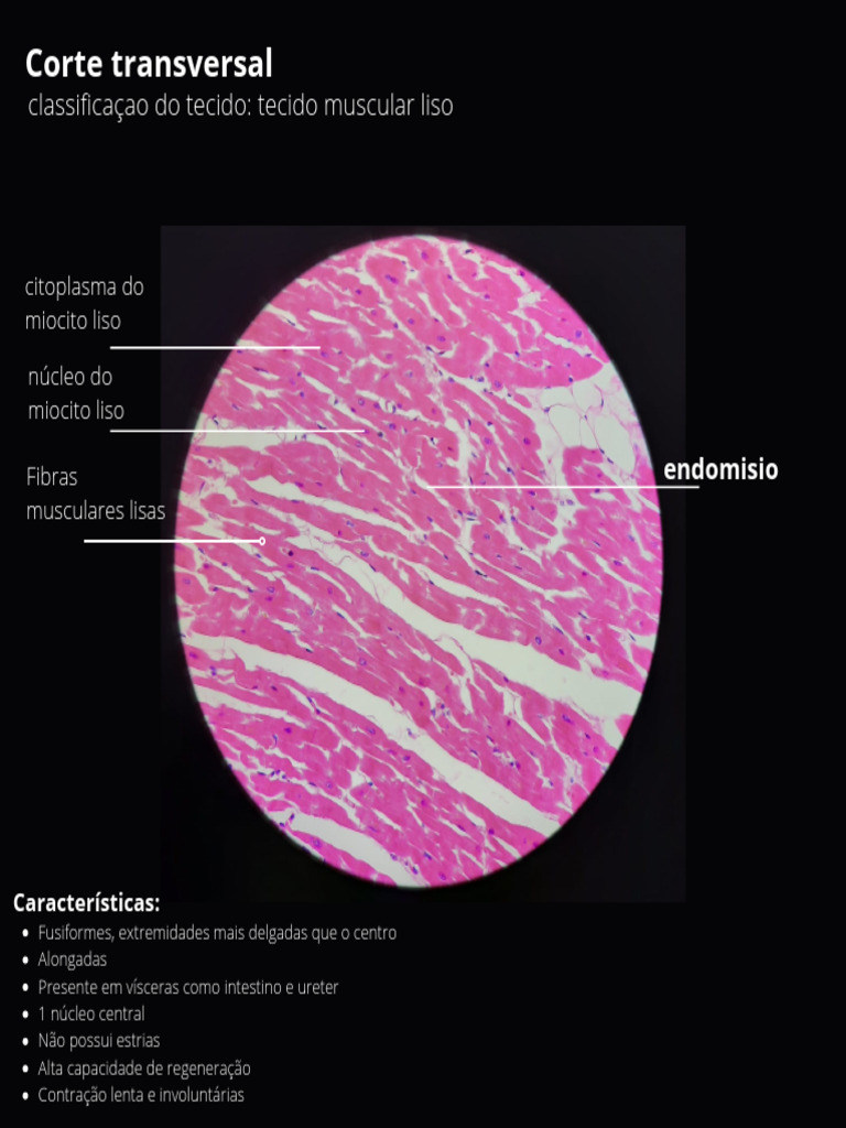 Miocitos Lisos e Esteriocilios em Tecido | PDF | Músculo esquelético ...