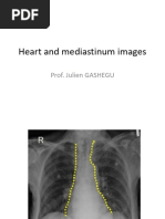 RTOG Heart Contouring Atlas | PDF | Heart | Atrium (Heart)