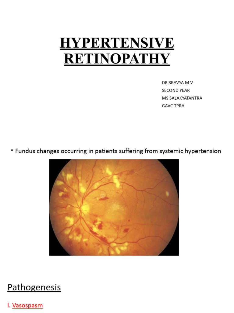 Hypertensive Retinopathy Overview and Staging | PDF | Retina | Physiology